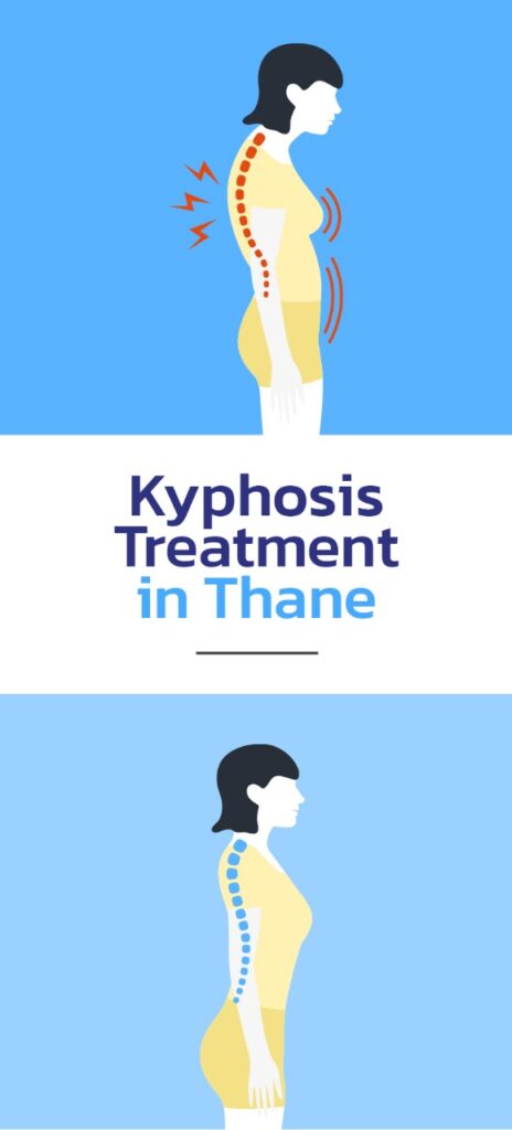 Specialized Kyphosis treatment in Thane | The Spine Clinic's Expertise