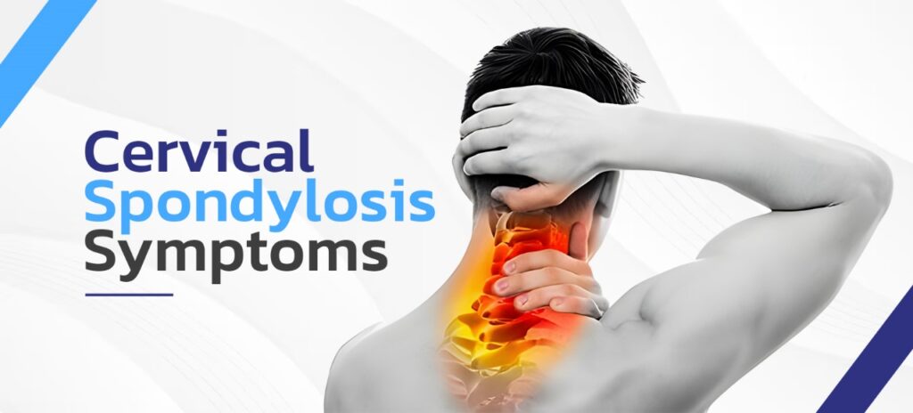 Cervical spondylosis symptoms