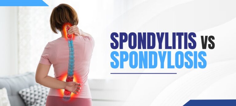 Spondylosis Vs Spondylitis