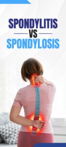 Spondylosis Vs Spondylitis